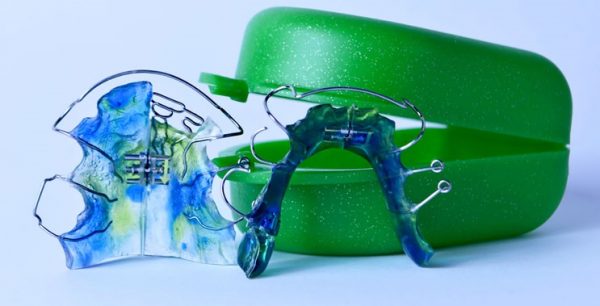 What are plates? How do they compare to braces? - Peninsula Orthodontics